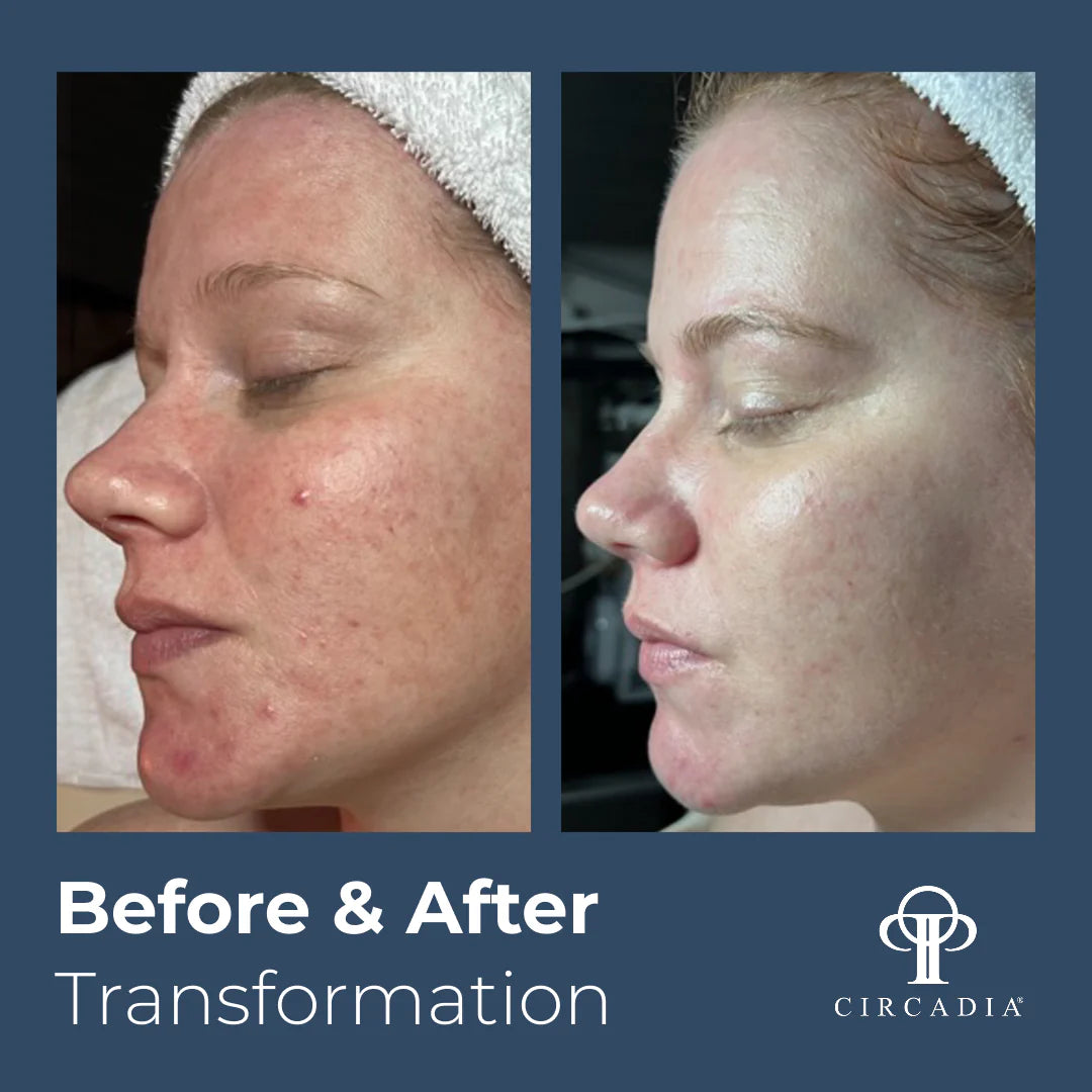 Calming Facial Complete Bundle – Circadia Skin Australia